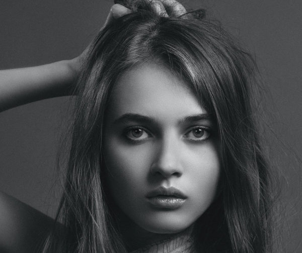 Lipofilling for a bumped forehead - Dr Lucas Plastic Surgery